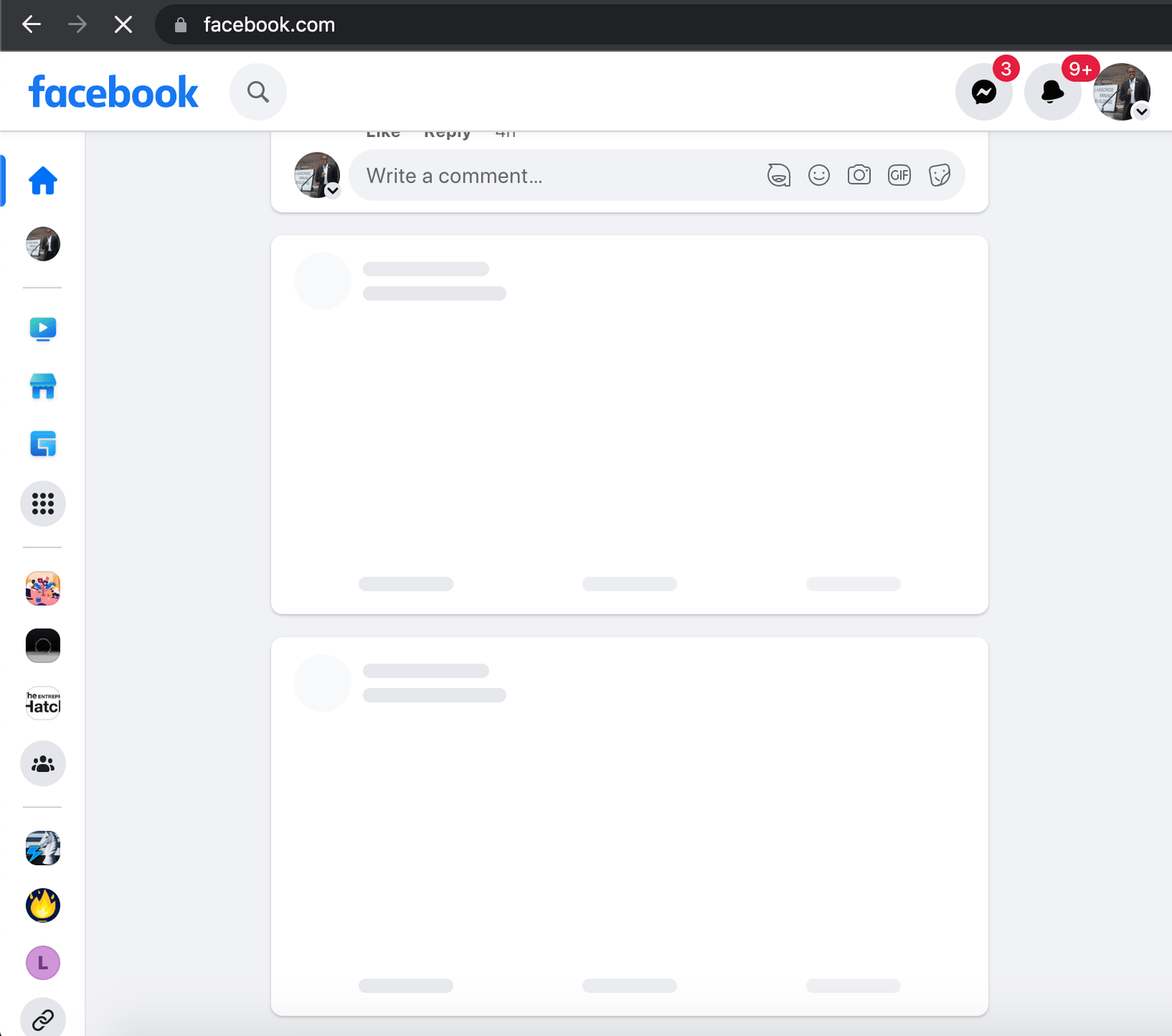 How To Build Loading Screens—kendoreacts Skeleton Component